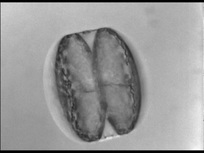 Coscinodiscus granii (Centrales) - Vegetative Vermehrung | Europeana